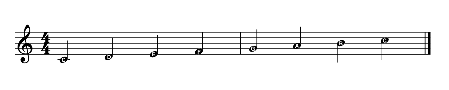 What is the name of this interval? Here is the answer!